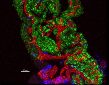 Studying The Choroid Plexus During Neuroinflammation In D Oxford Instruments