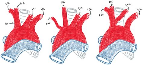 Introduction To Anatomical Variation Anatomical Variation An Australian And New Zealand Context