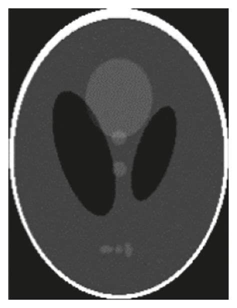Images Reconstructed Using The DcTV CP Algorithm And Varying T1 Ae