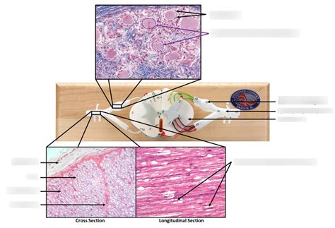 Dorsal Root Ganglion Diagram Quizlet