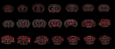 Independent Hypothalamic Circuits For Social And Predator Fear Ipmc