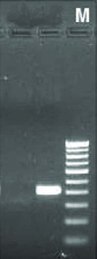 Detection Of Gene Encoding Bla Ctx M 15 In Extended Spectrum Download Scientific Diagram