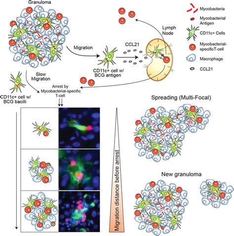 Dendritic Cell Induced Granulomatous Renewal And Spreading Proposed