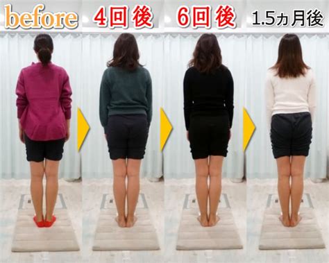 O脚 X脚 診断 123631