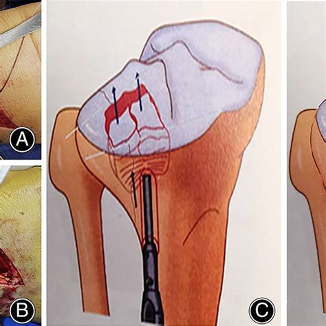 Flowchart Demonstrating Patient Selection And Analysis Download Scientific Diagram