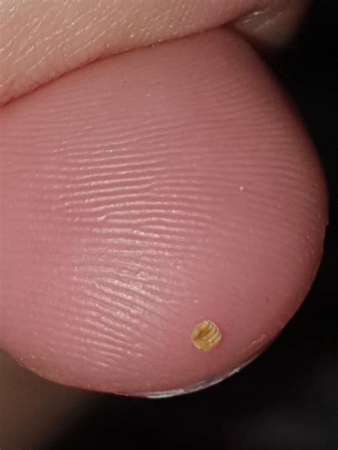 Is This A Bed Bug Shell Rwhatsthisbug