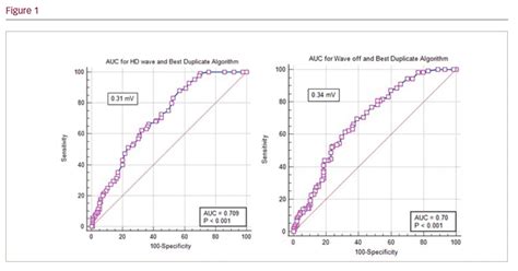 51 Assessment Of Optimal Thresholds For Ventricular Scar Substrate