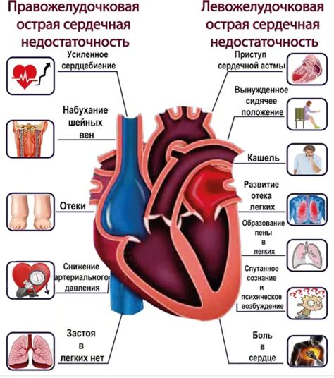 Лечение и диагностика сердечной недостаточности - Медицинский центр ...