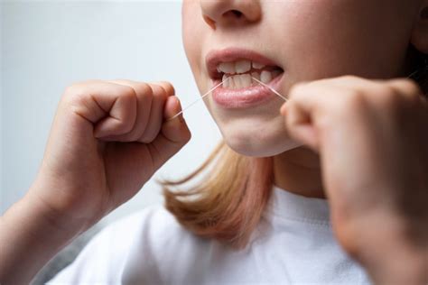 What Is Fluoride Varnish Understanding Its Role In Oral Health My