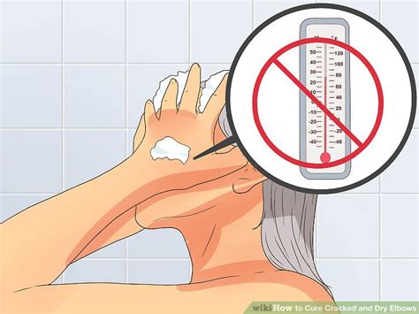 How To Cure Cracked And Dry Elbows 14 Steps With Pictures