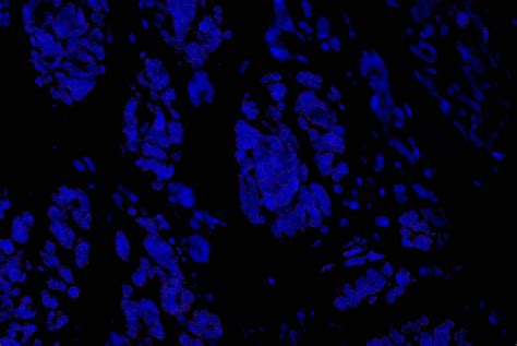 Hla Dpb1 Efish Probe For Precise Genetic Analysis Omicsveu