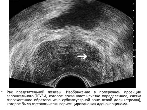Лучевая диагностика заболеваний эндокринной системы презентация онлайн