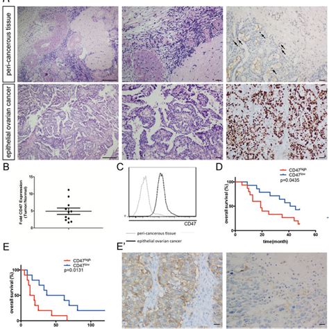 Cd47 Expression Is Elevated In The Ovarian Cancer Stem Cell Like