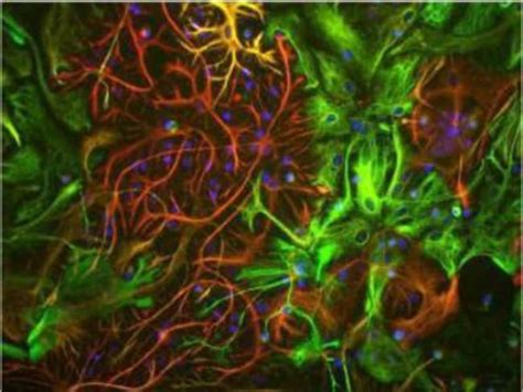 Vimentin Mouse Anti Human Rat Mouse Negative Clone 2d1 Novus
