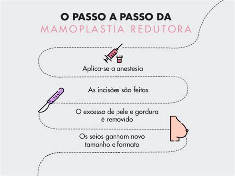 Mamoplastia Redutora Tudo Sobre L Dream Plastic