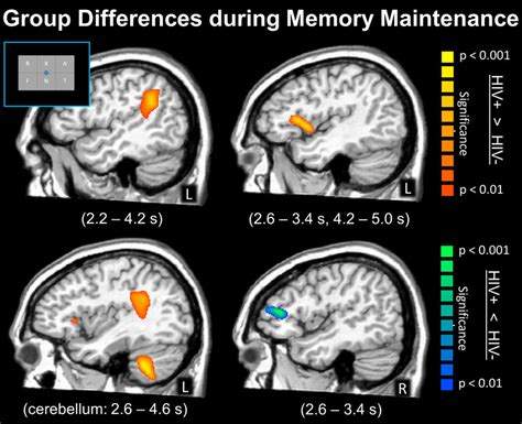 Group Oscillatory Differences During Working Memory Maintenance Download Scientific Diagram