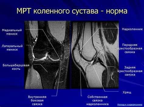 Магнитно резонансная томография презентация онлайн