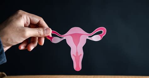 Pcos Polycystic Ovary Syndrome Symptoms Causes Complications