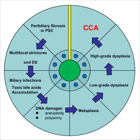 Pathogenesis Of Cca In Psc Peribiliary Fibrosis In Psc Causes
