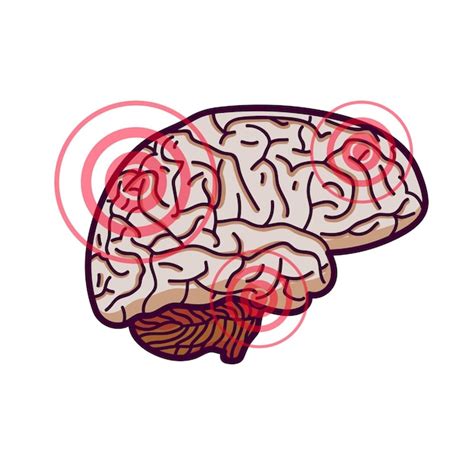 Premium Vector Human Brain With Pulsating Circles Of Pain Isolated On