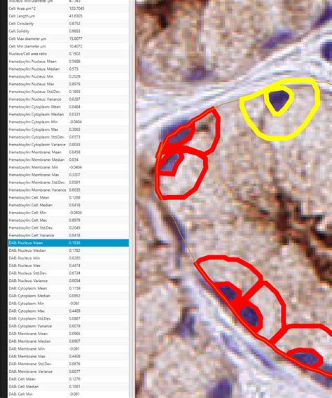 When Scripting Intensity Measurements For Detections The Names Are
