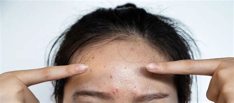 How To Deep Cleanse Your Face Effective Tips For At Home Deep Facial