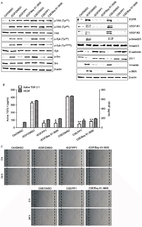 Syksrc Activation Regulates The Secretion Of Vegf And Tgf β1 In