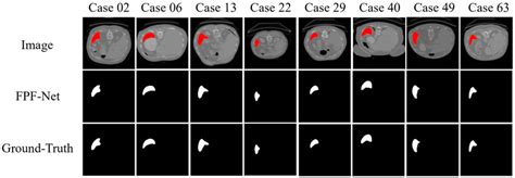 Examples Of Segmentation Results Predicted By Our Fpf Net On The Msd