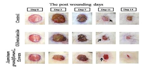 The Excision Wound Healing Time Course Noted On Post Wounding Days 0