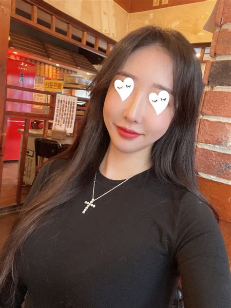 청담동피부과 튠페이스 리프팅 반년만에 재시술 후기멍붓기가격 네이버 블로그