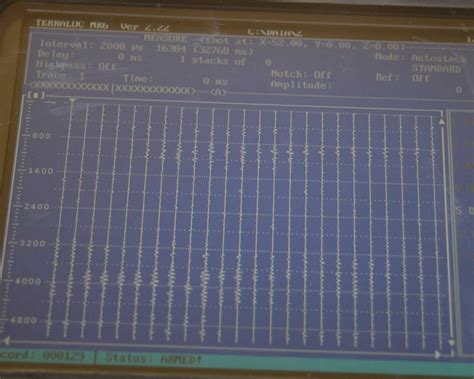 Passive Seismic Z A P Consulting Engineers