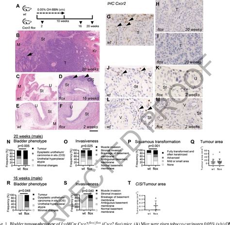 Figure 1 From Loss Of Cxcr2 In Myeloid Cells Promotes Tumour