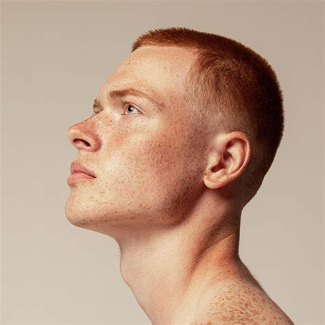 Laser Hair Removal Men Archon