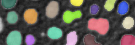️ Image Segmentation — The Image Analysis Field Guide