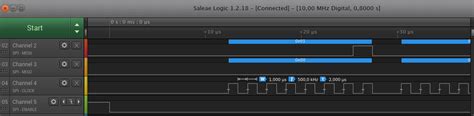 Bad Default Value For Spi Clock Speed Maxspeedhz Messing Up