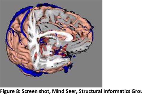 figure 1 from spatial symbolic query engine in anatomy semantic scholar