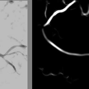An Example To Illustrate The RNN Based Method From Left To Right Are Download Scientific