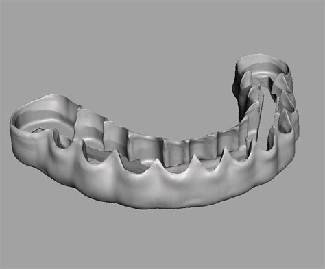 Stl File Dental Prosthesis・model To Download And 3d Print・cults
