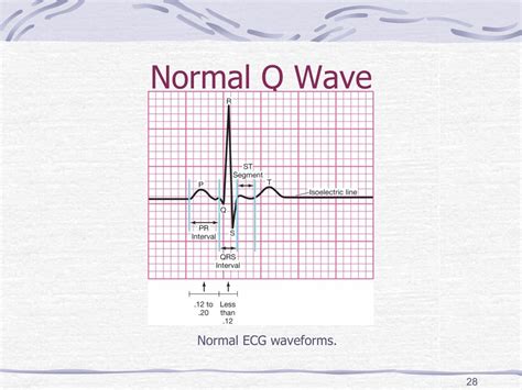 Ppt Coronary Artery Disease Cad Powerpoint Presentation Free