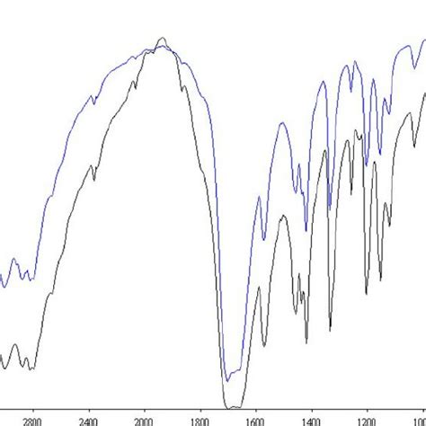 Pdf Xanthinuria Type I A Rare Cause Of Urolithiasis