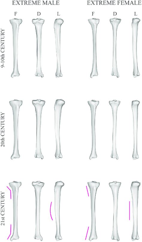 Extreme Male And Female Tibiae Extreme Tibial Shapes Which Are Download Scientific Diagram
