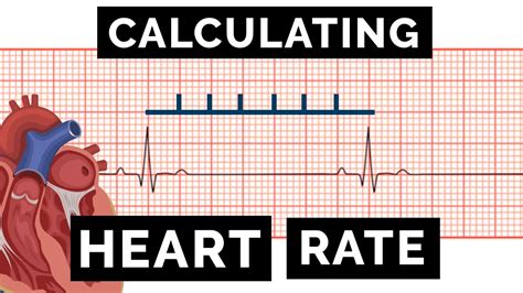 How To Calculate Atrial Rate On Ecg Printable Templates Protal
