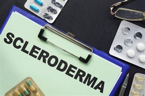 Understanding Scleroderma Visiting Angels Ravenna