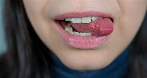 How To Stop Biting Tongue In Sleep Liberty Village Dental Care