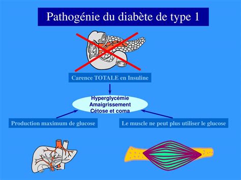 PPT Les diabètes généralités de base PowerPoint Presentation free