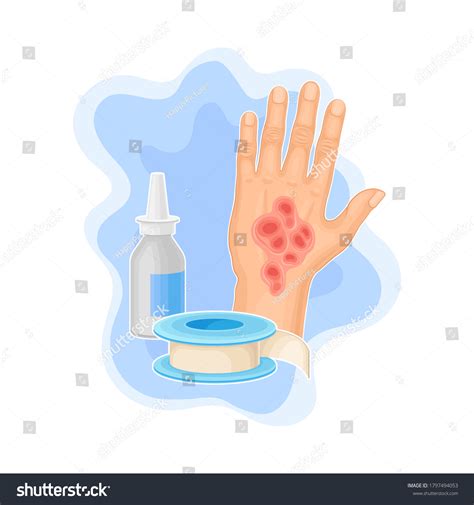17 Burn Wound Covering Stock Vectors Images And Vector Art Shutterstock