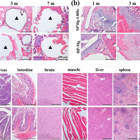 A Histological Analysis Of The Bone Tissues Surrounding The Implants