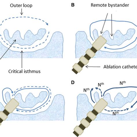 Schematic Representation Of The Reentry Circuit A Tentative