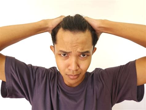 Premium Photo Shocked Face Of Asian Man Getting Bald And Lost Hair In