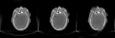Multimodality Medical Imaging Inverse Problems Research Group
